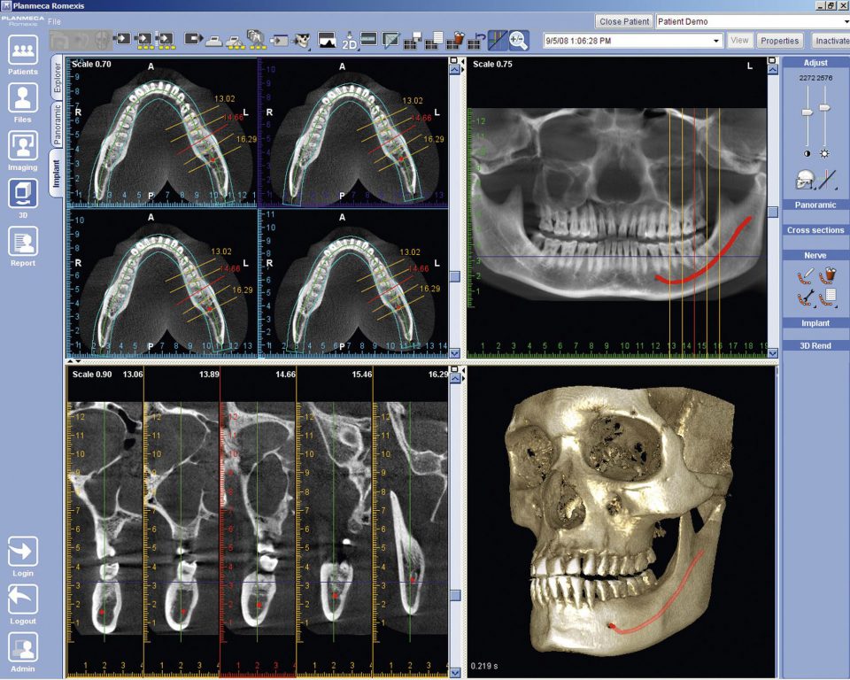 Digitales Röntgen/DVT-3D Röntgen › Zahnarztpraxis Hanft